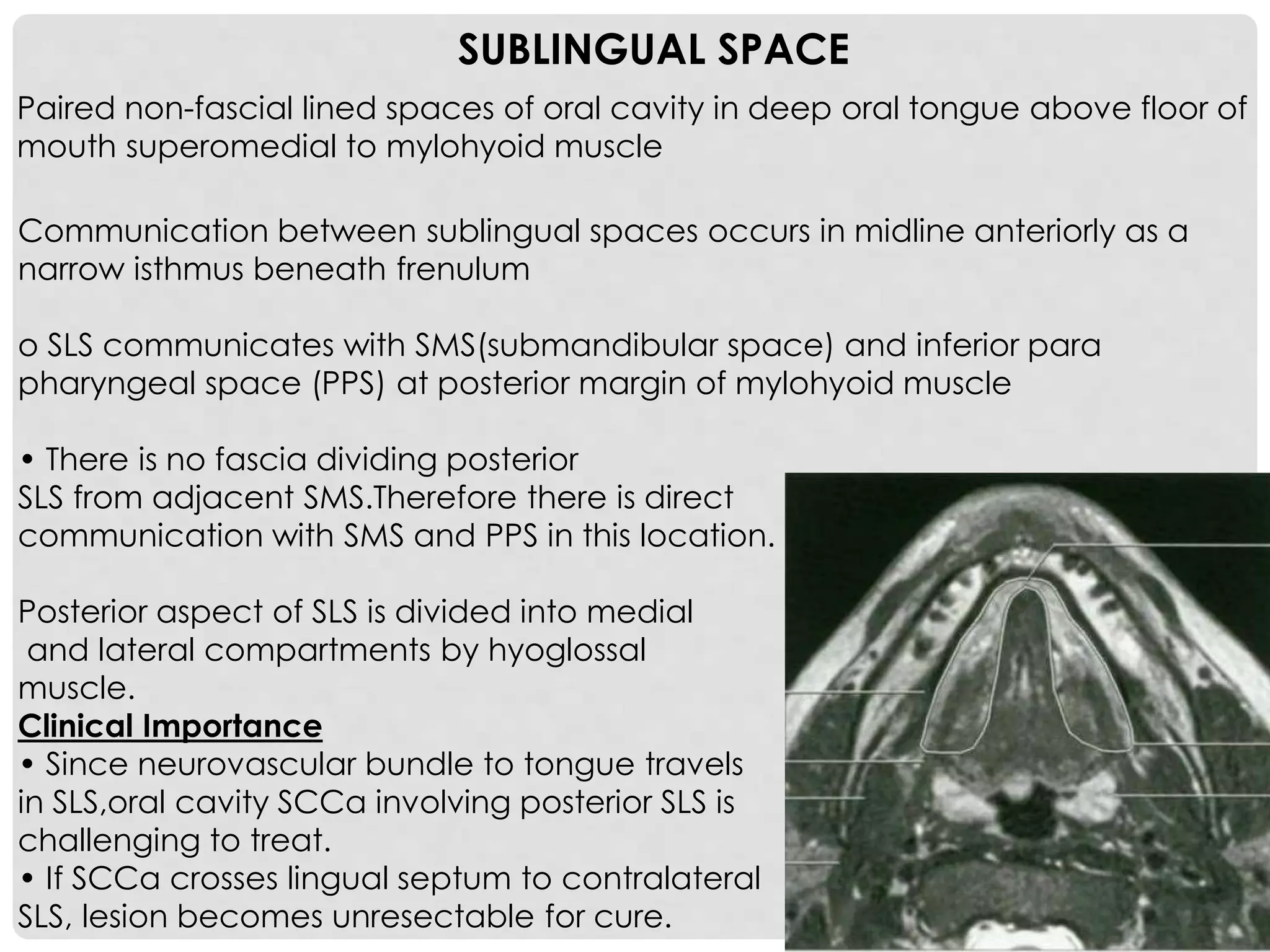 Oral cavity, pharynx radio-anatomy | PPTX