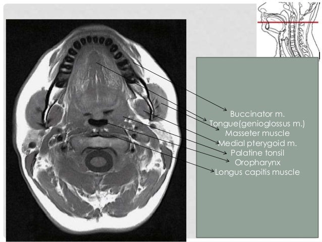 Oral cavity, pharynx radio-anatomy