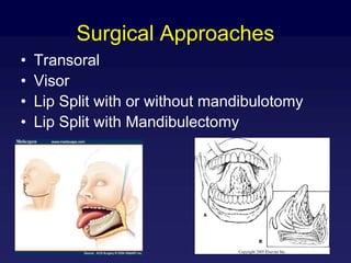 Oral cavity Ppt internet.ppt