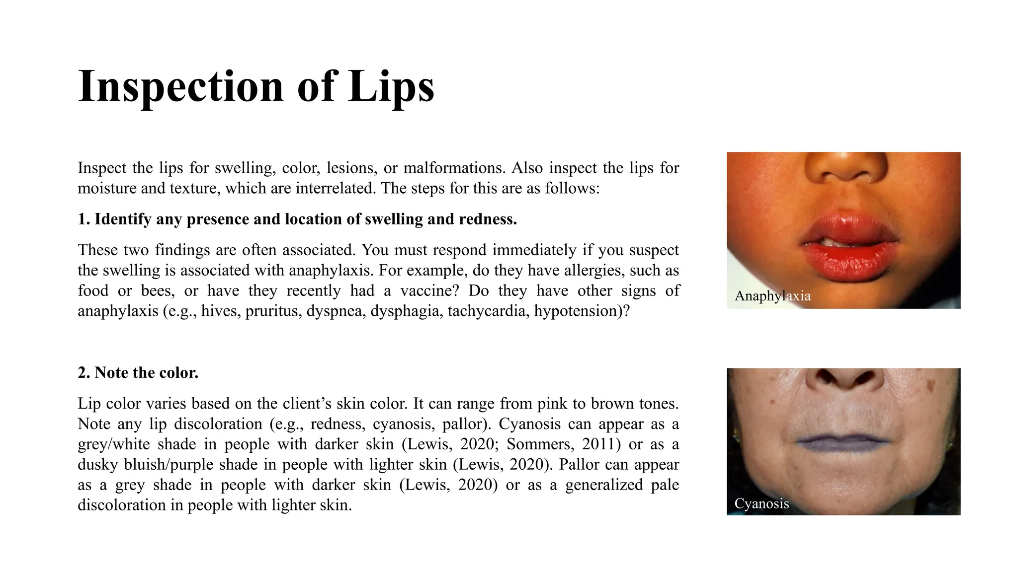 ASSESSMENT Of ORAL CAVITY PROPER ppt pptx | PPTX