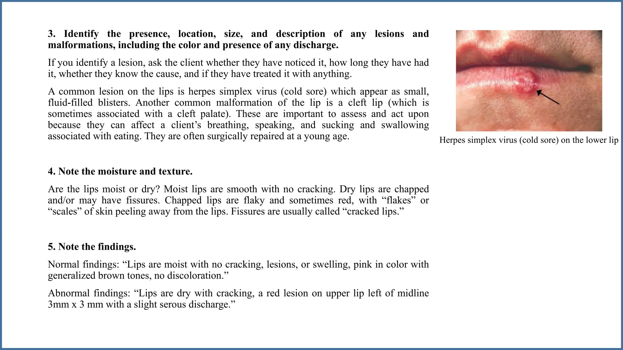 ASSESSMENT Of ORAL CAVITY PROPER ppt pptx | PPTX
