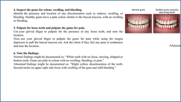 ASSESSMENT Of ORAL CAVITY PROPER ppt pptx | PPT