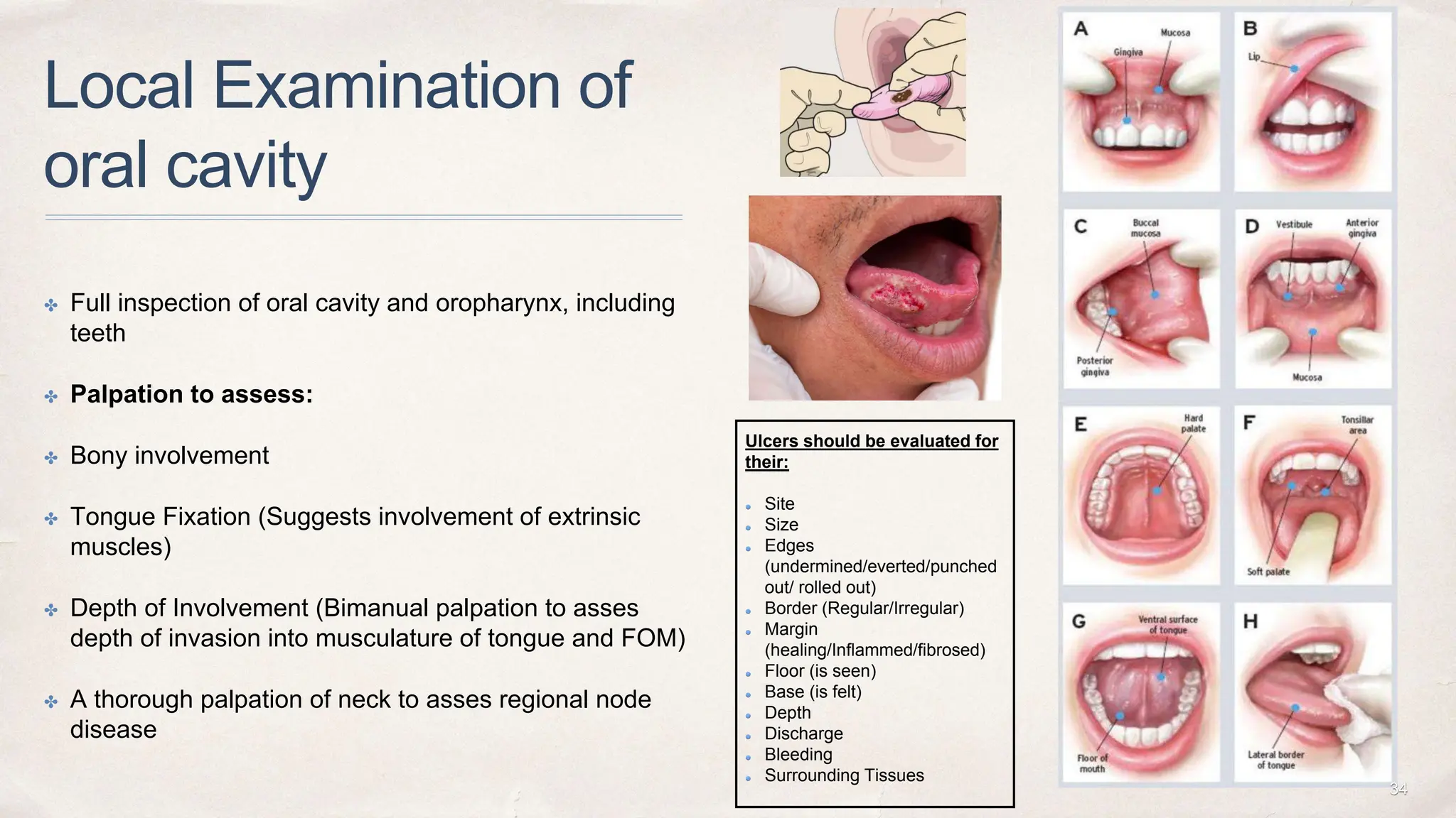oral cavity radiology.pptx radiation oncology | PPTX
