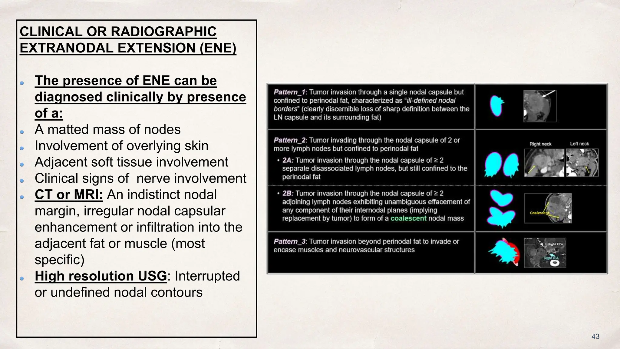 oral cavity radiology.pptx radiation oncology | PPT oral cavity radiology.pptx radiation oncology | PPT