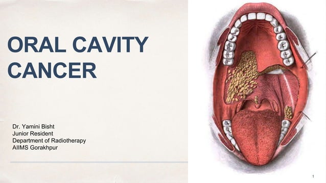 oral cavity radiology.pptx radiation oncology | PPTX