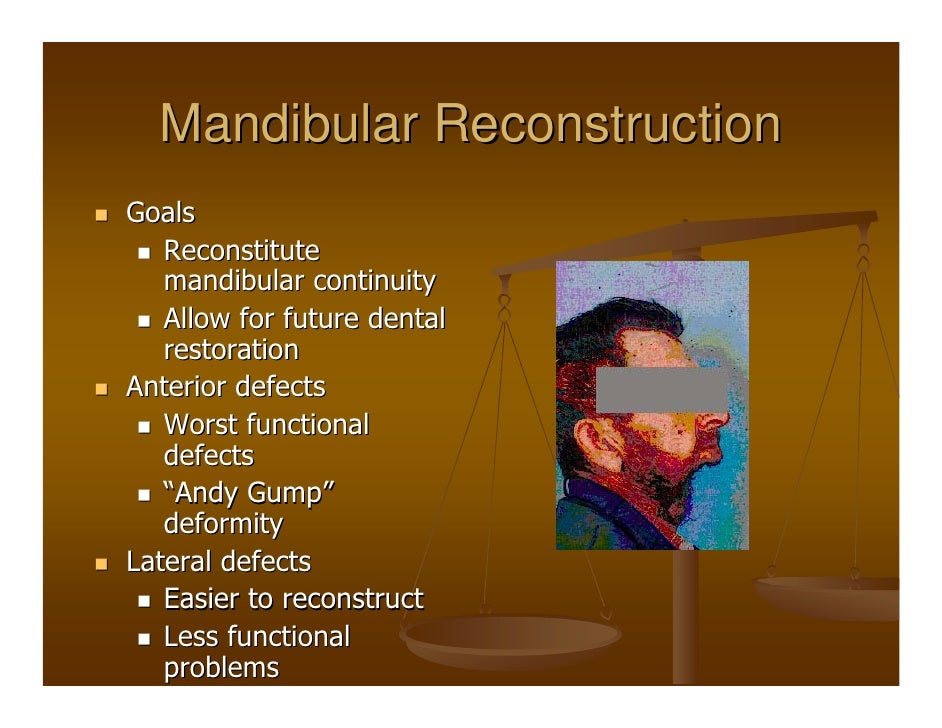Andy Gump Deformity : Primary Reconstruction in Segmental Resection of ...