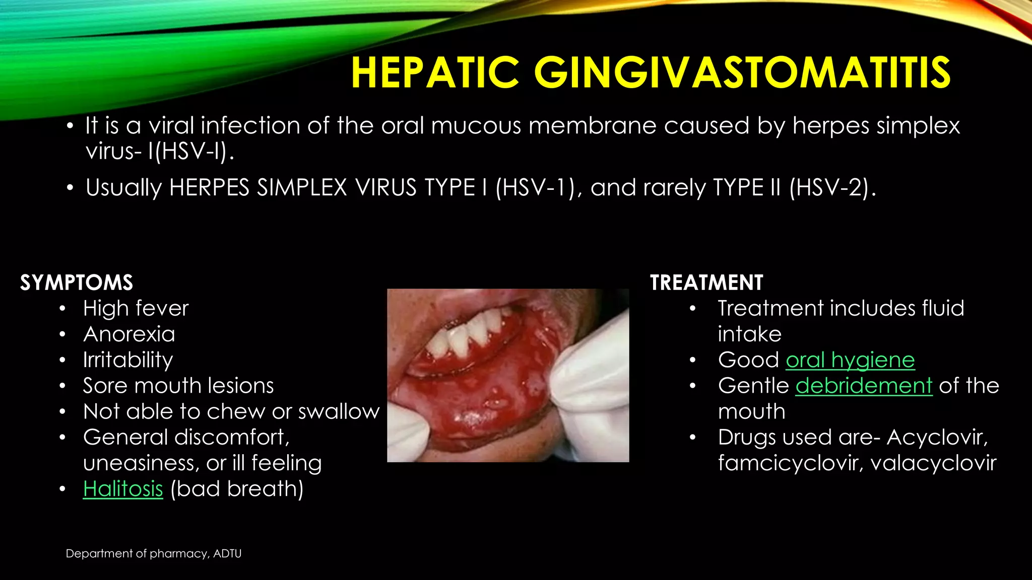 Common disease of oral cavity | PDF