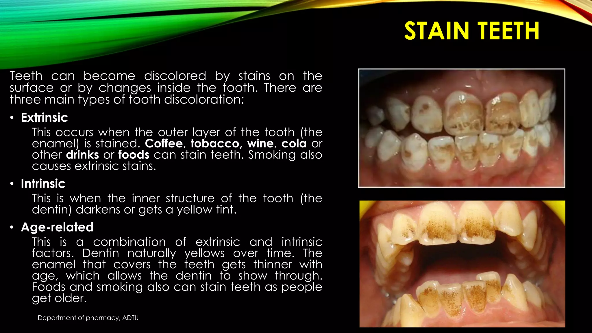 Common disease of oral cavity | PDF