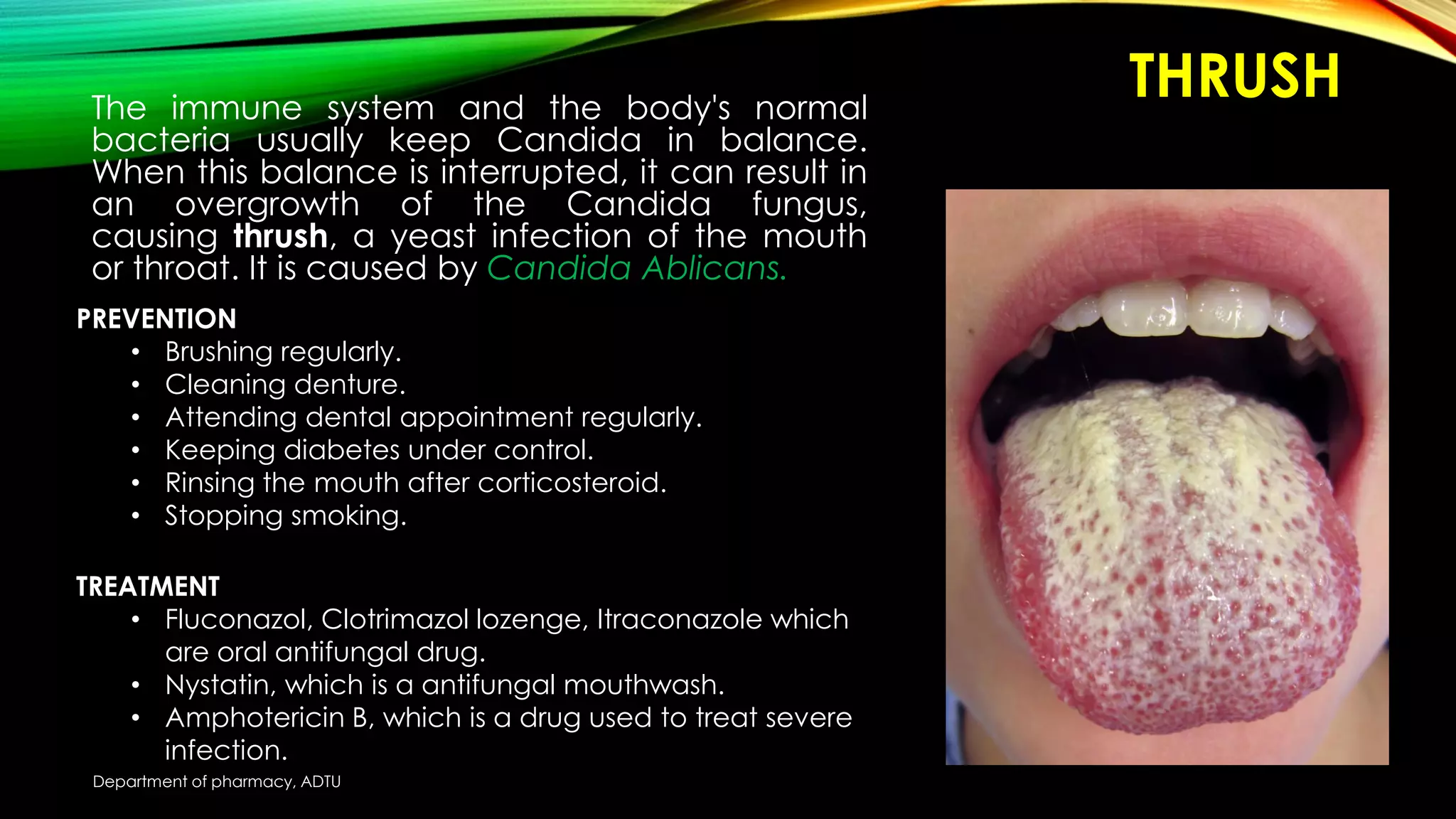 Common disease of oral cavity | PDF