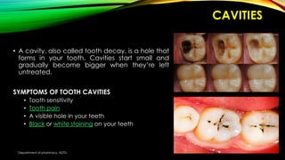Common disease of oral cavity | PDF