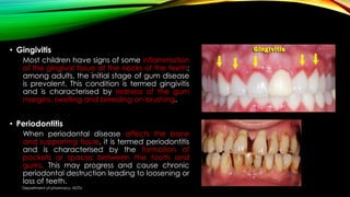 Common disease of oral cavity | PDF