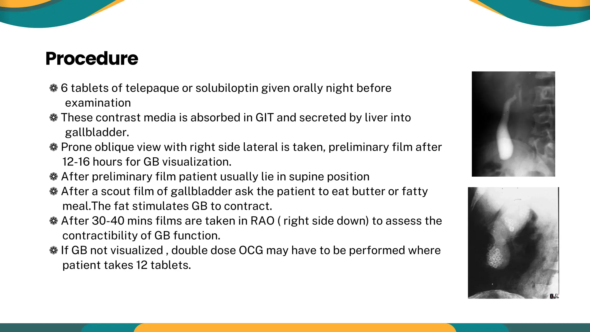 Oral Cholangiography procedure done in radiology department | PDF