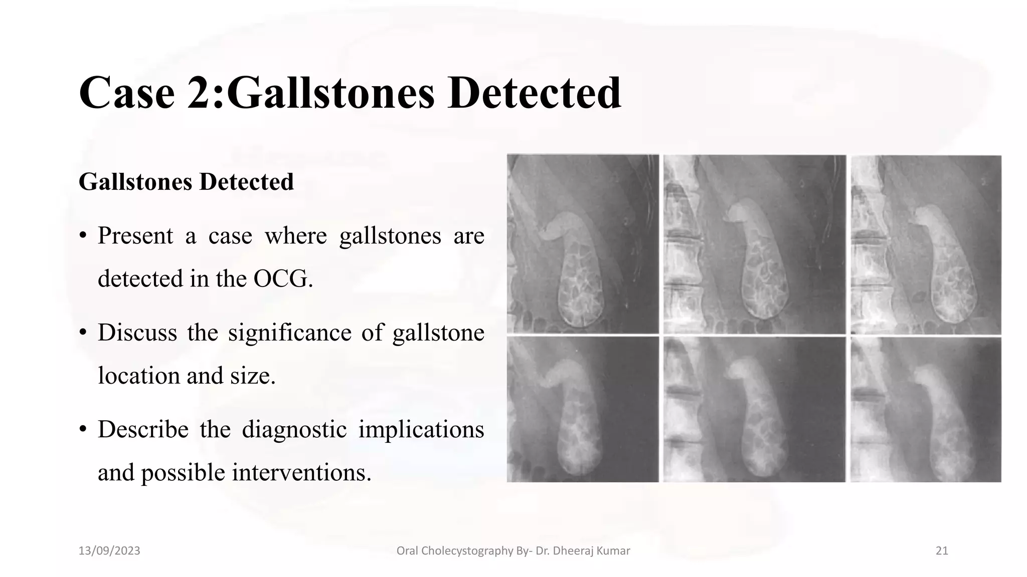 Oral Cholecystography .pptx