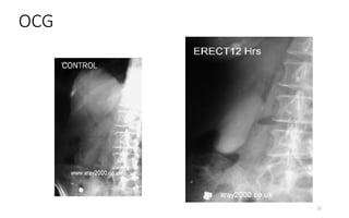 TOPIC MEDICAL IMAGING ORAL CHOLECYSTOGRAPHY.ppt