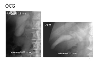 TOPIC MEDICAL IMAGING ORAL CHOLECYSTOGRAPHY.ppt