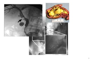 TOPIC MEDICAL IMAGING ORAL CHOLECYSTOGRAPHY.ppt