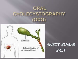 Oral cholecystography (ocg) | PPTX