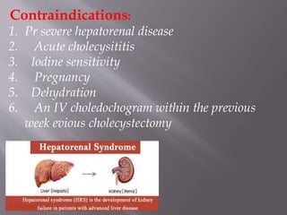 Oral cholecystography (ocg) | PPTX