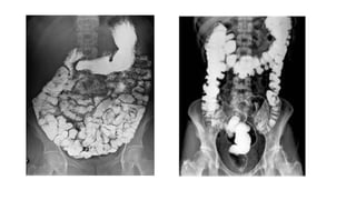 Oral contrast agents | PPTX