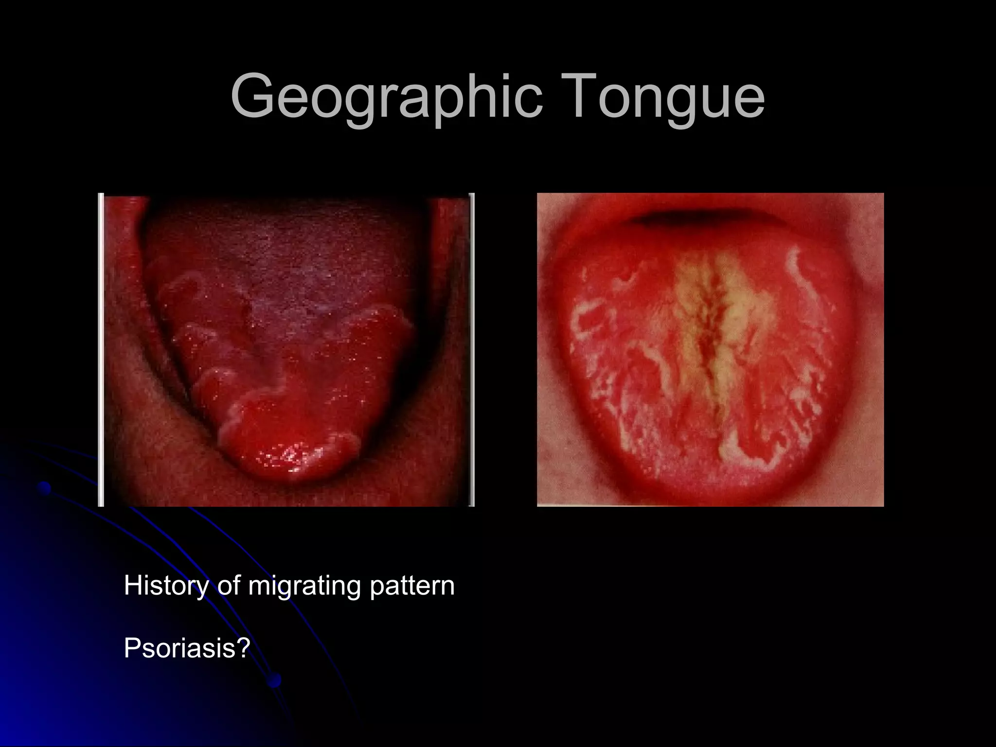 Oral diagnosis and systemic diseases | PPT