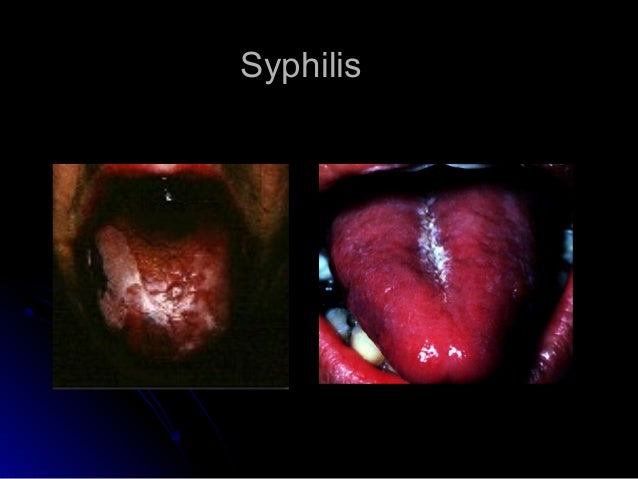 Oral Diagnosis And Systemic Diseases