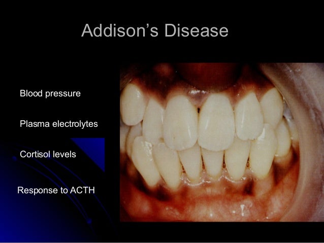 Oral diagnosis and systemic diseases