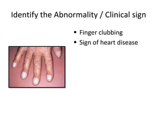 Oral diagnosis clinical examination | PPTX