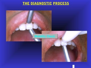 Oral diagnostic process (part -3) | PPT