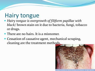 Oral diseases - Benign and premalignant lesions | PPTX
