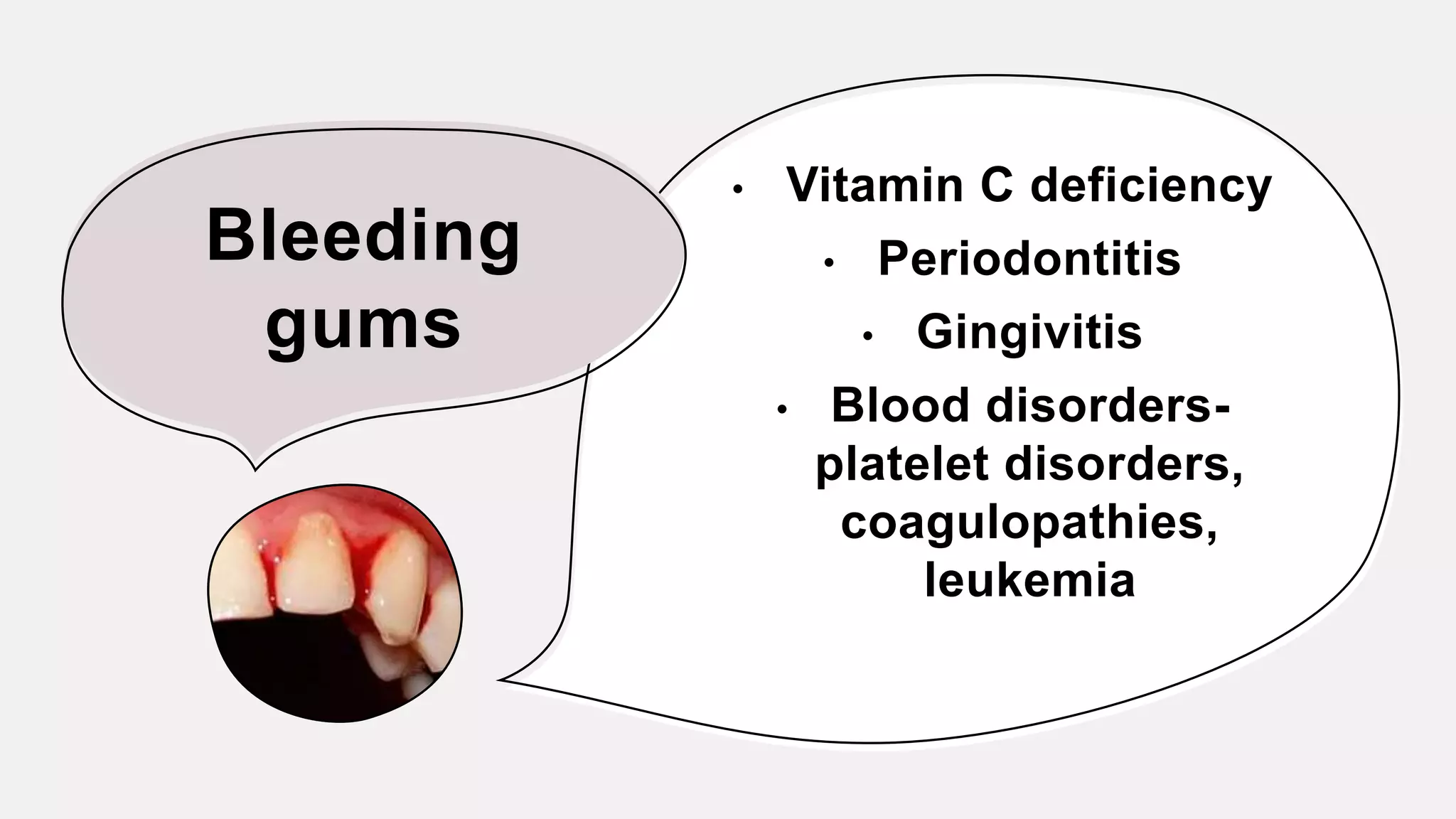 ORAL DISEASES.pptx
