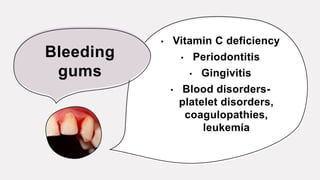 ORAL DISEASES.pptx