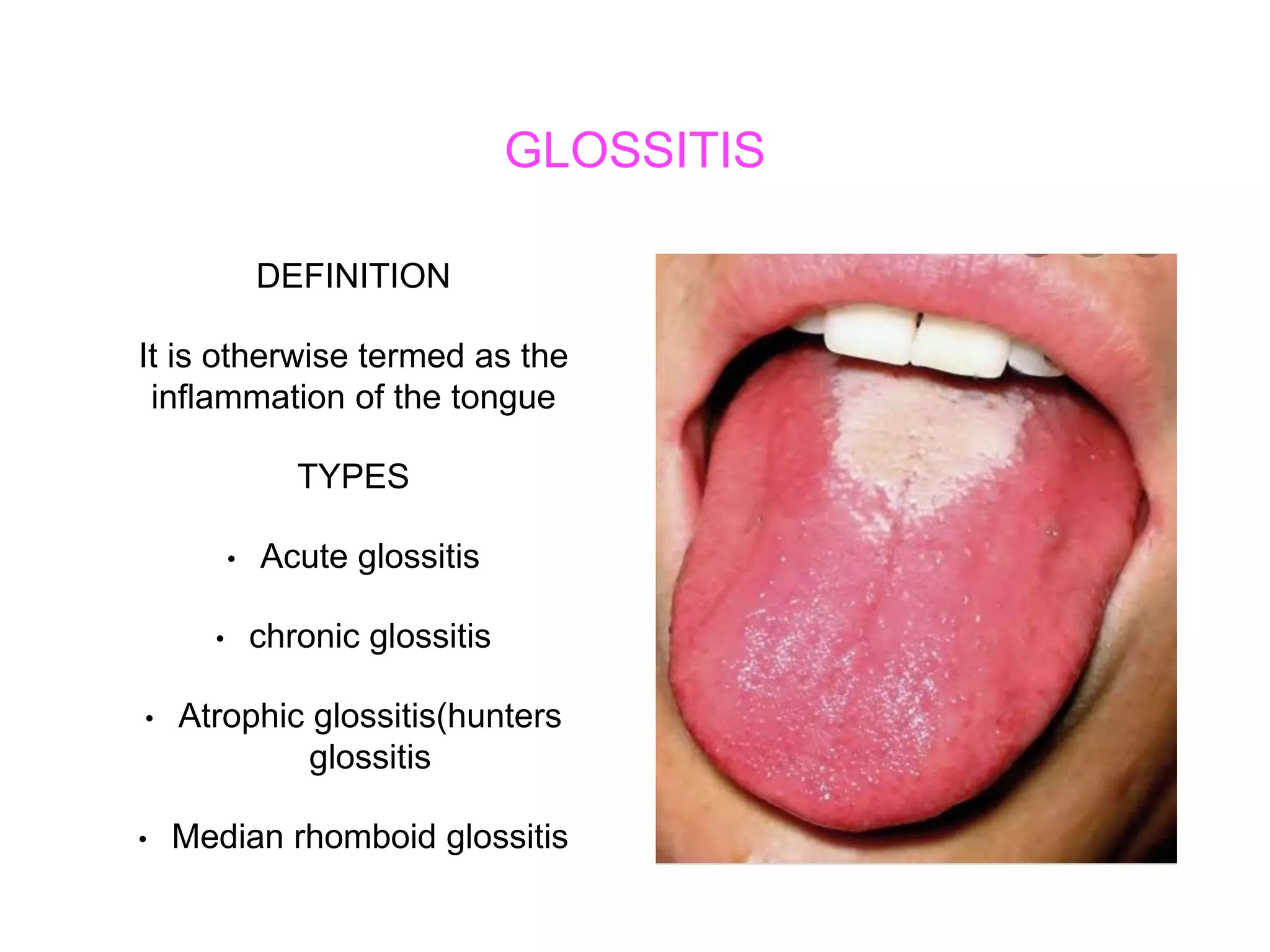 Oral disorders ppt. | PPTX