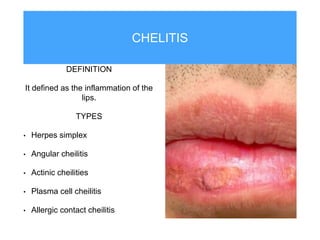 Oral disorders ppt. | PPTX