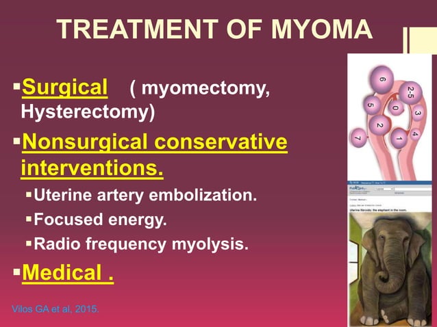 Oral drugs for myoma | PPT