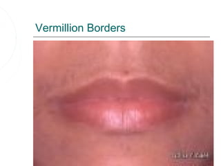 Oral effects of_smokeless_tobacco