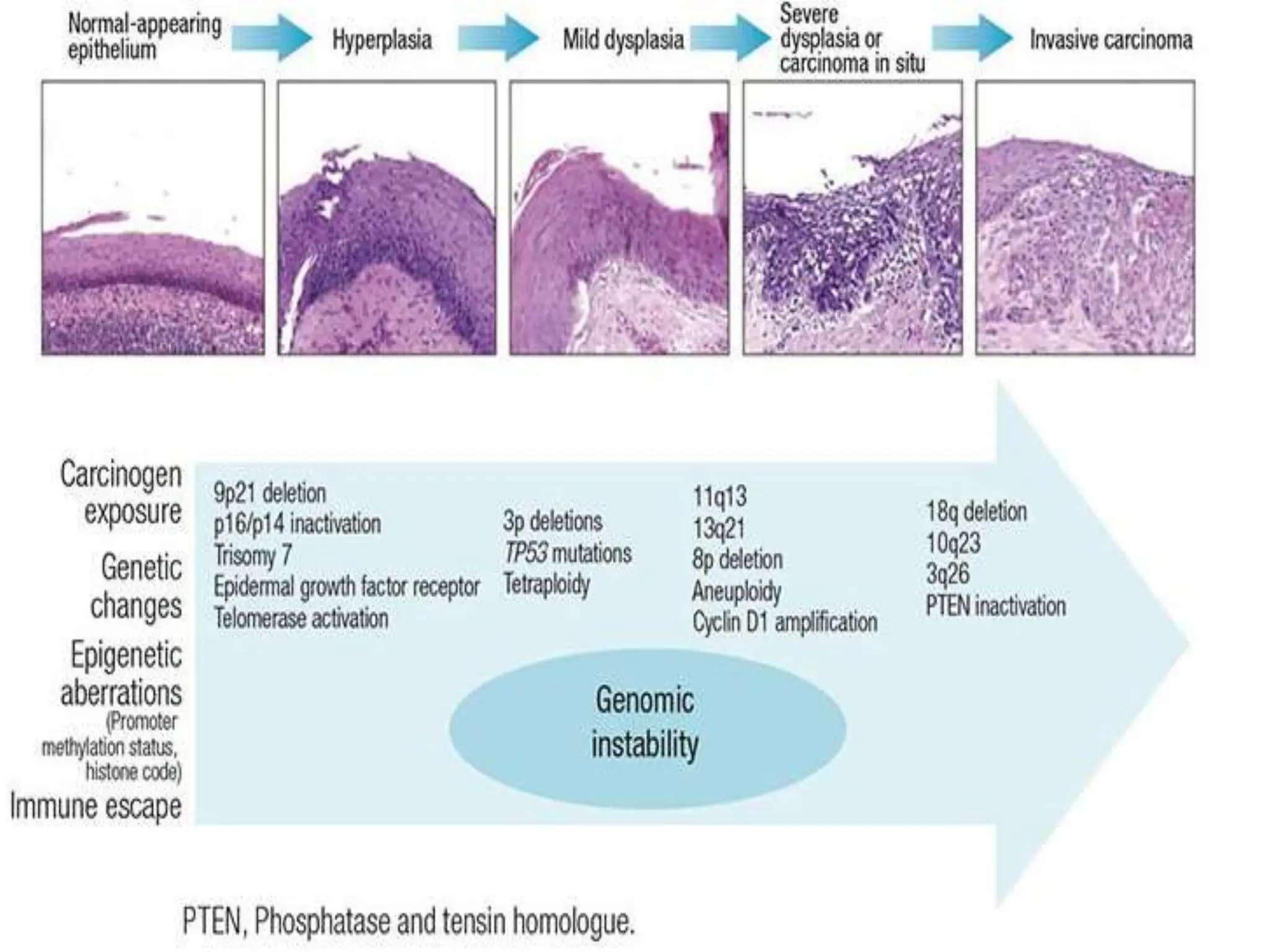 ORAL EPITHELIAL DYSPLASIA: recognition, grading, and clinical ...