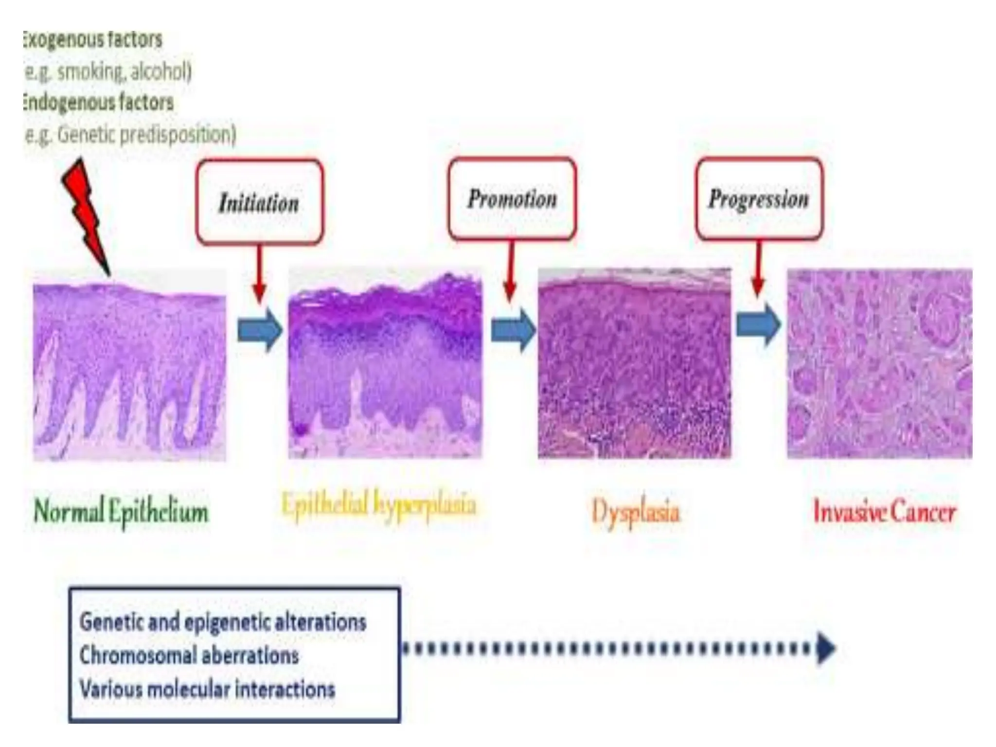 ORAL EPITHELIAL DYSPLASIA: recognition, grading, and clinical ...