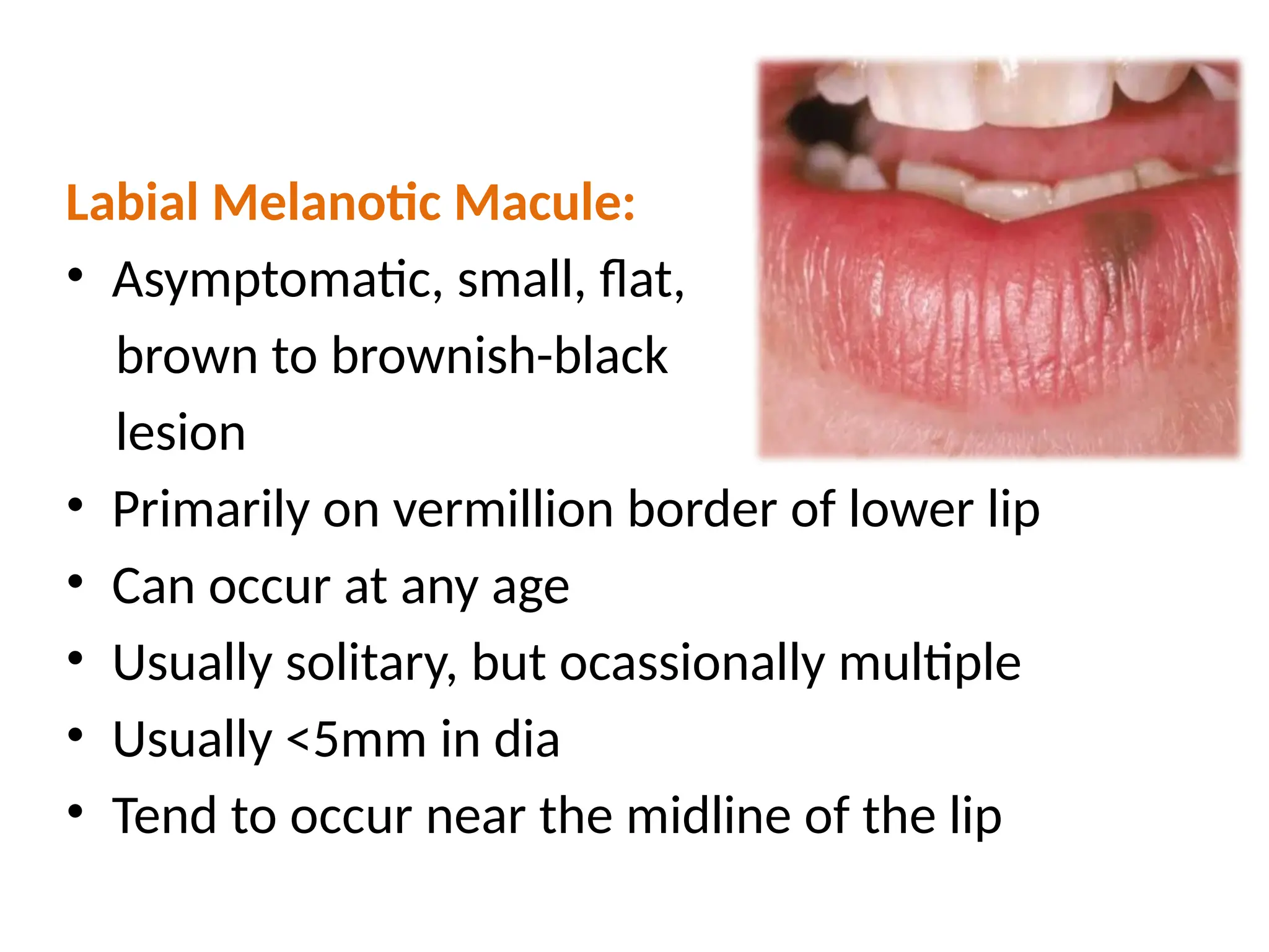 Oral epithelial tumors, melanocytic naevi & malignant melanoma.pptx