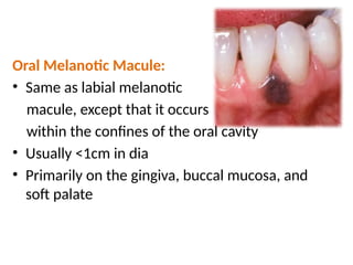 Oral epithelial tumors, melanocytic naevi & malignant melanoma.pptx
