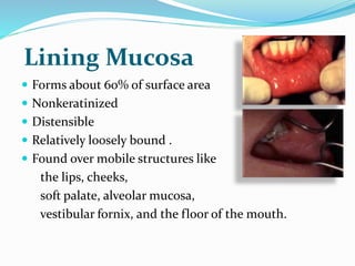 Non Keratinized Mucosa