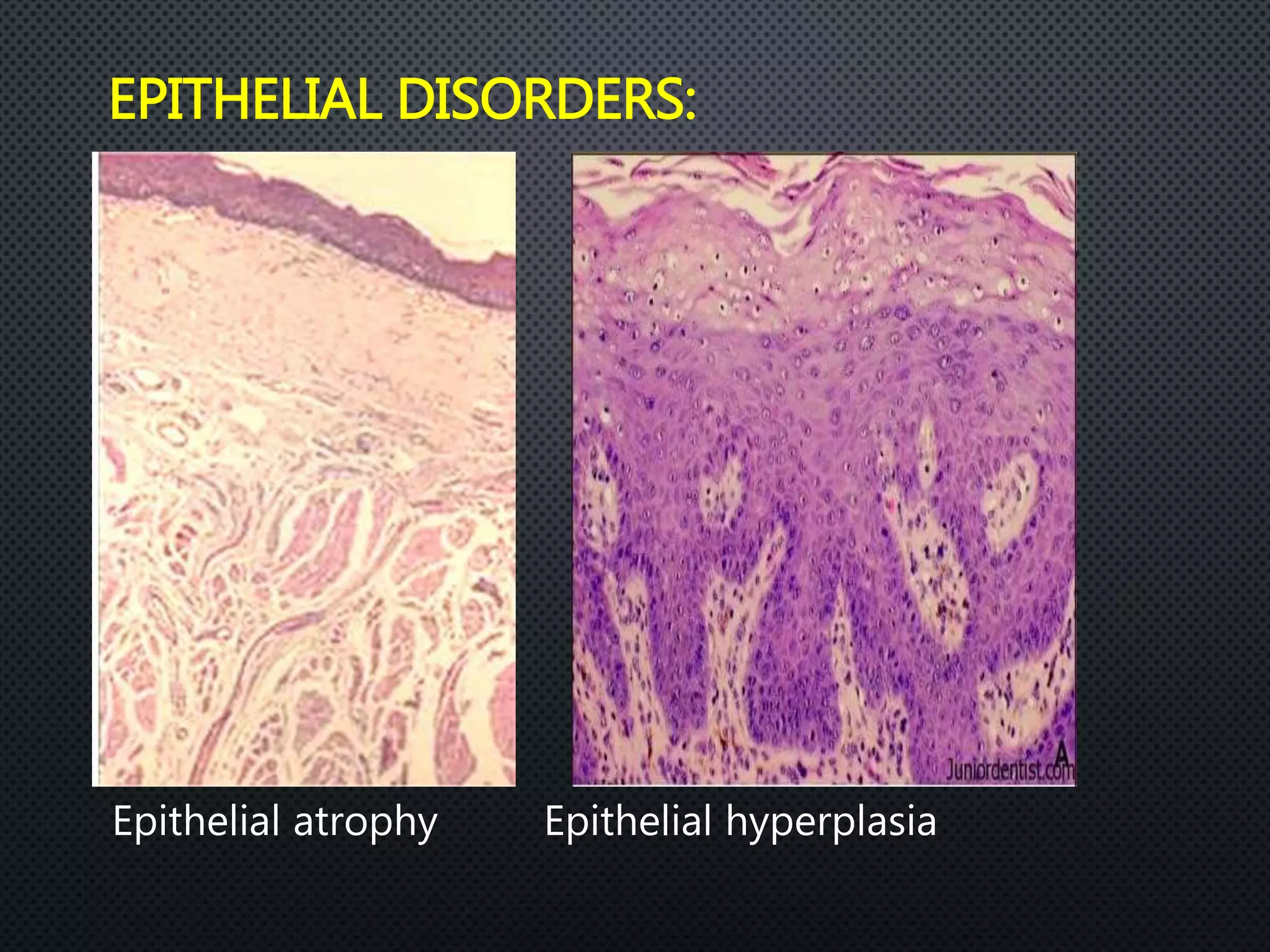 Oral epithelium , dr naveen reddy | PPTX | Skin and Dermatology ...