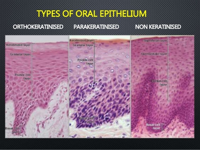 Oral epithelium , dr naveen reddy