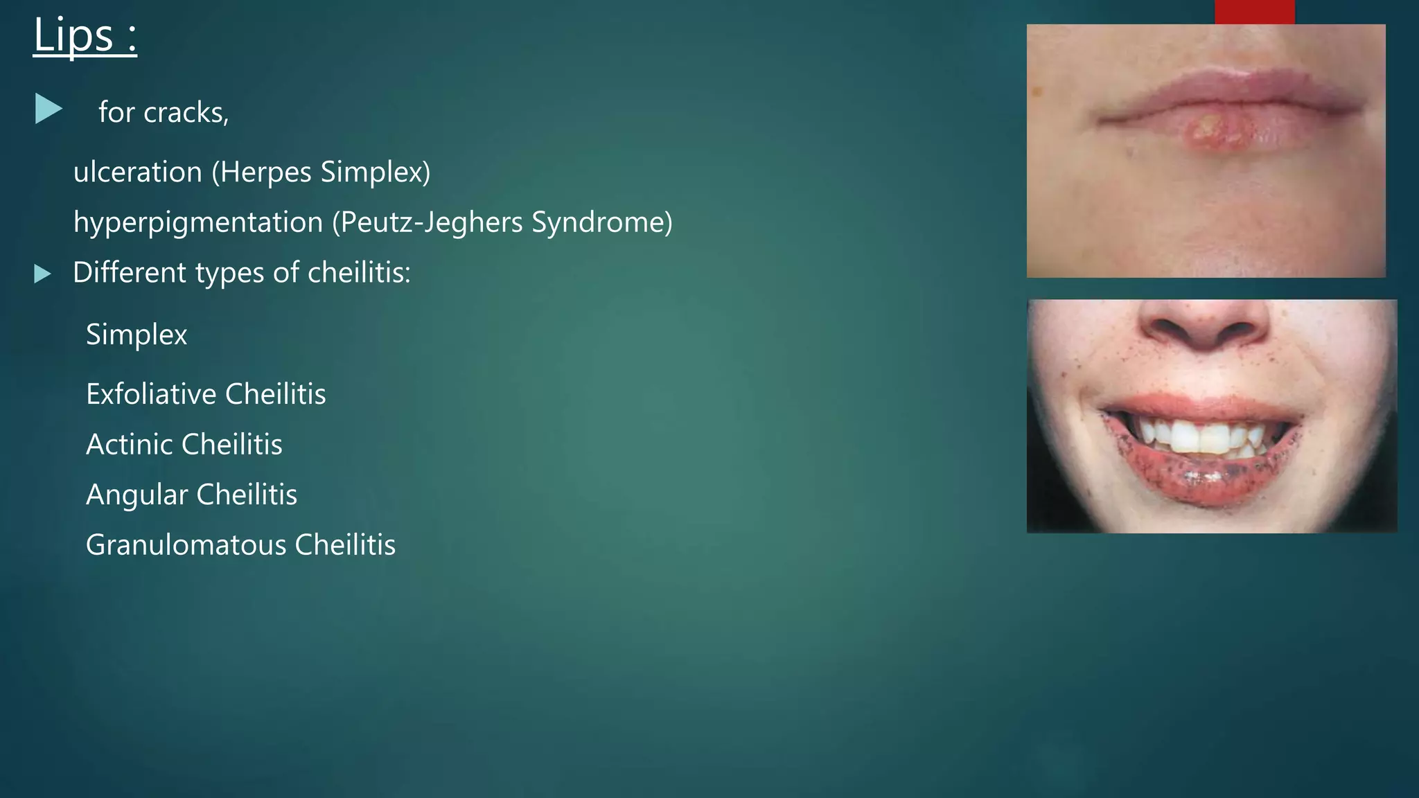 Oral Examinations.pptx