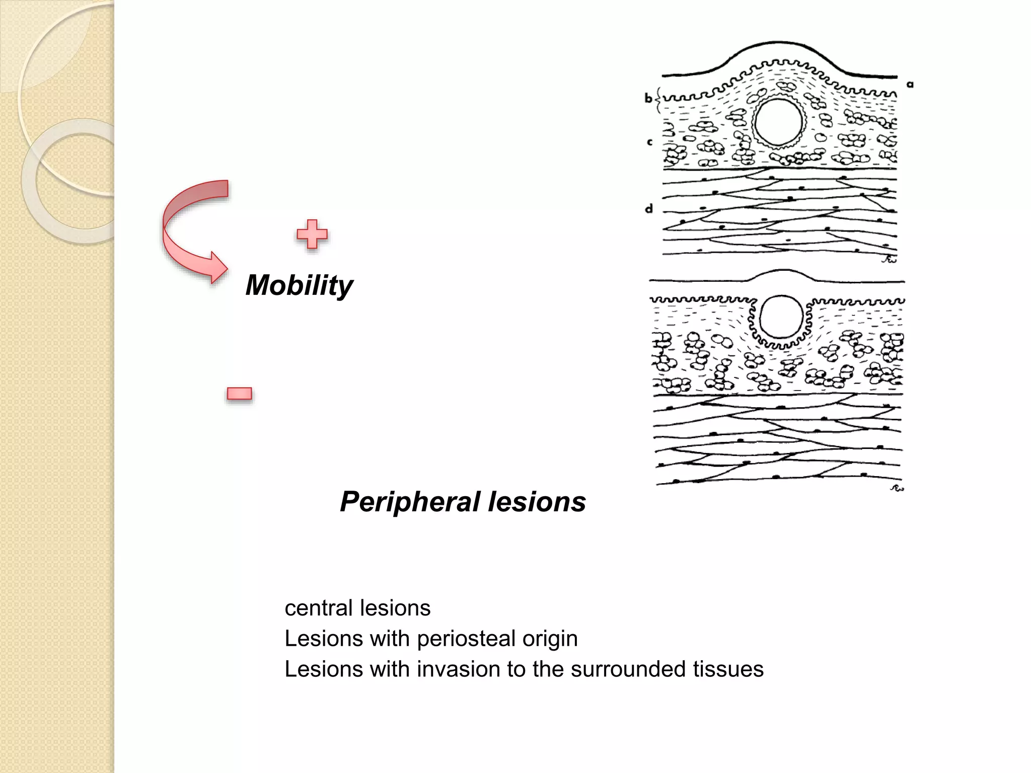 Oral exophytic lesions | PPTX