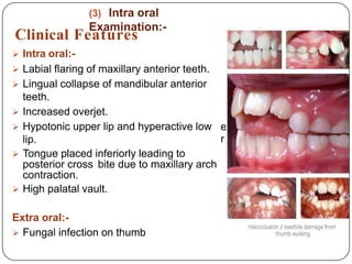 ORAL HABITS.pptx