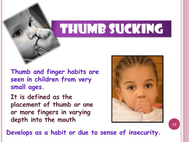 Oral habits - pedodontics | PPT