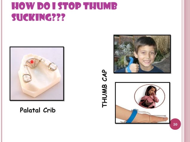 Oral habits - pedodontics | PPT