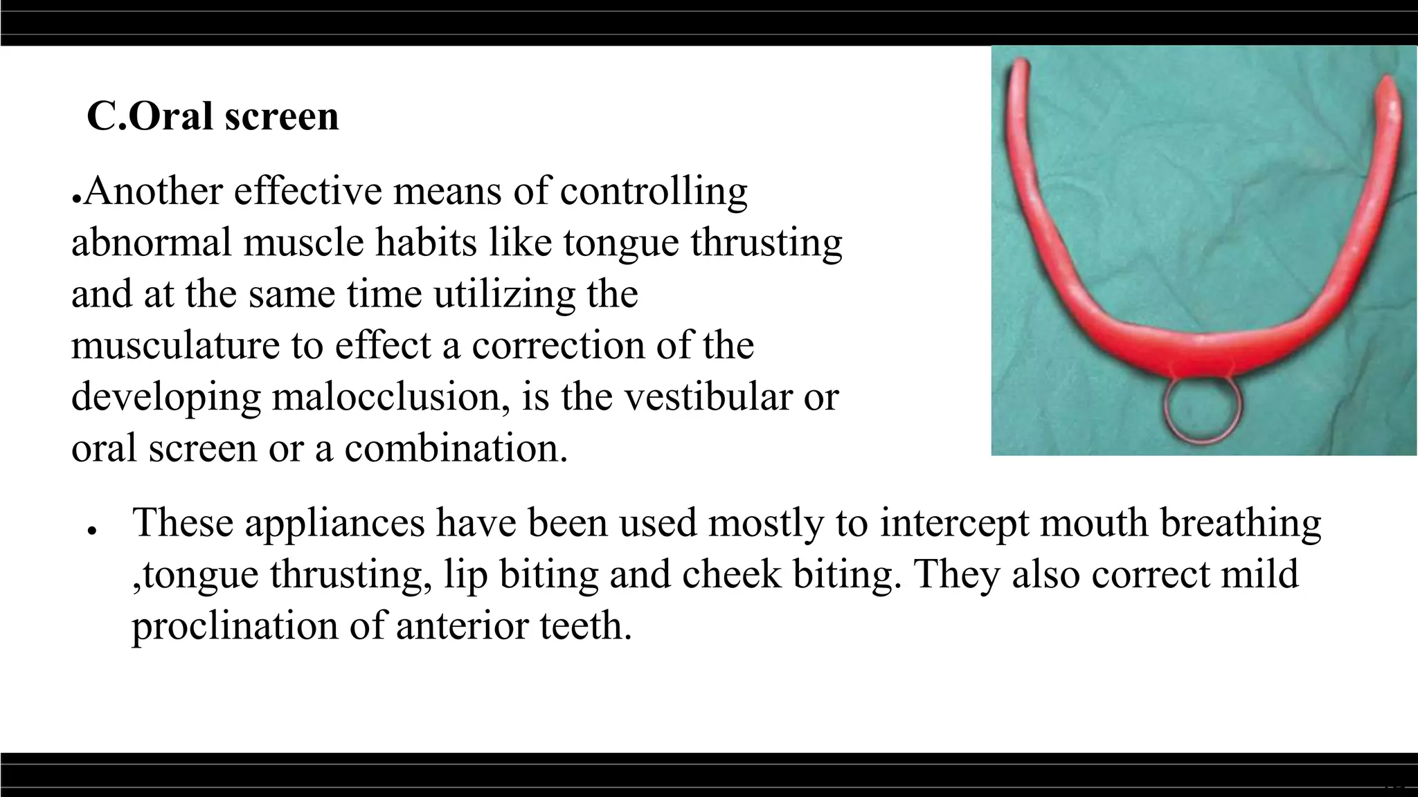Oral habits (part 2) tongue thrusting | PPTX