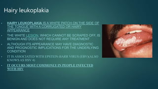 Hairy Leukoplakia Vs Leukoplakia
