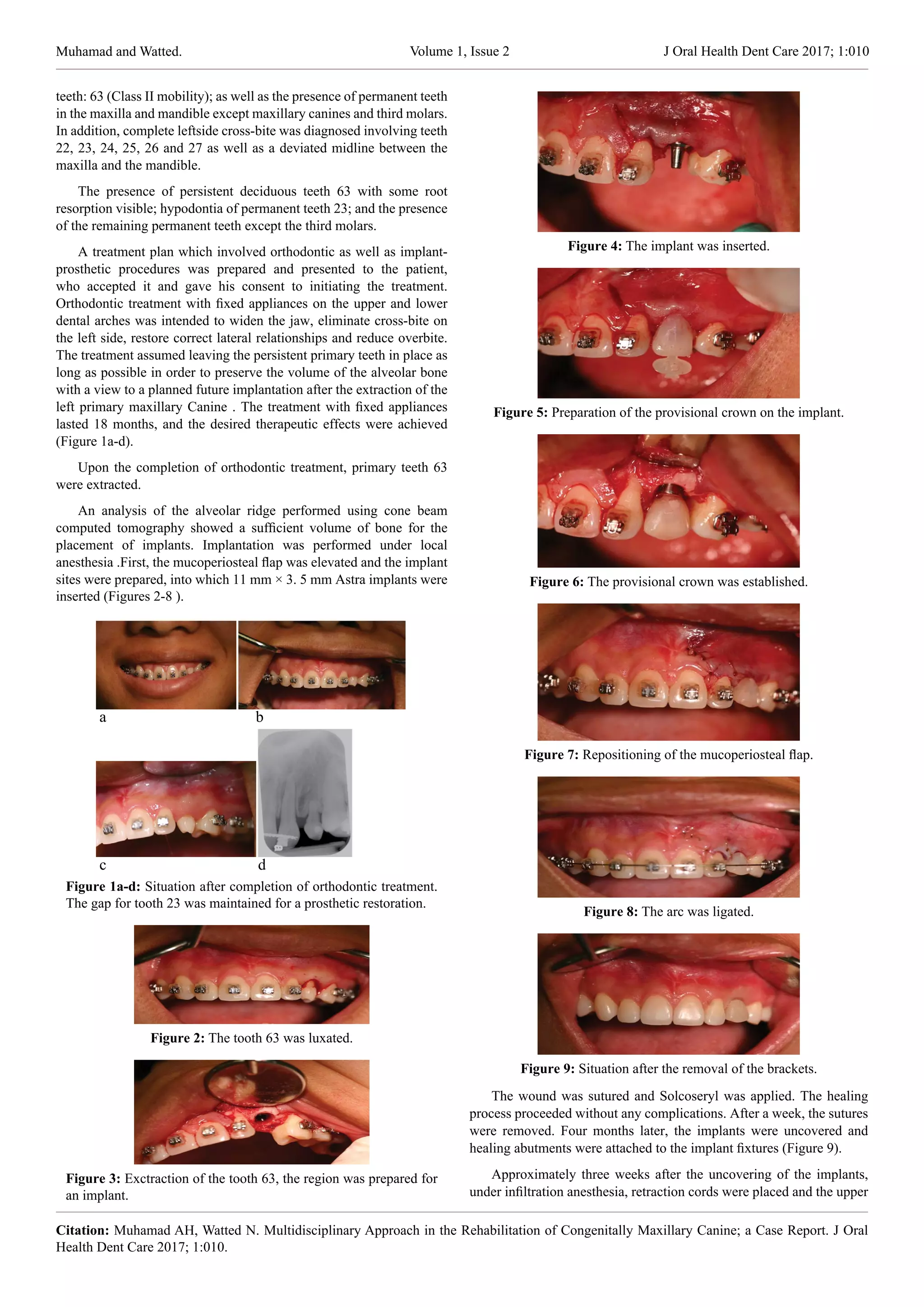 Multidisciplinary Approach in the Rehabilitation of Congenitally ...